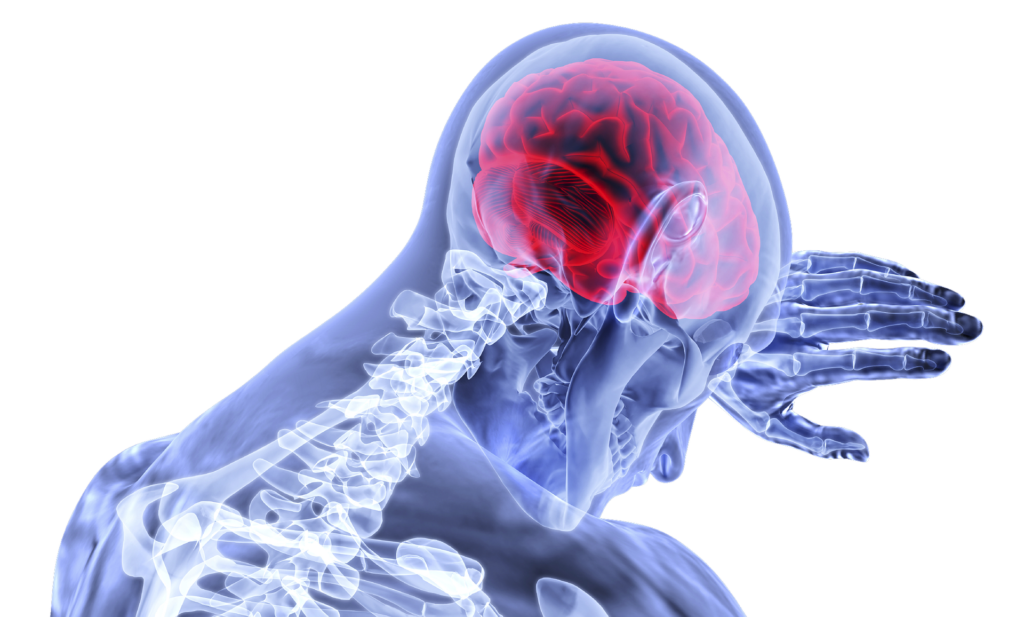 Concussion: Why Am I STILL Experiencing Symptoms?